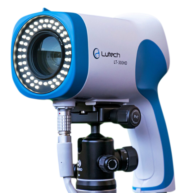 Lutech Digital Colposcope - Lutech Medical
