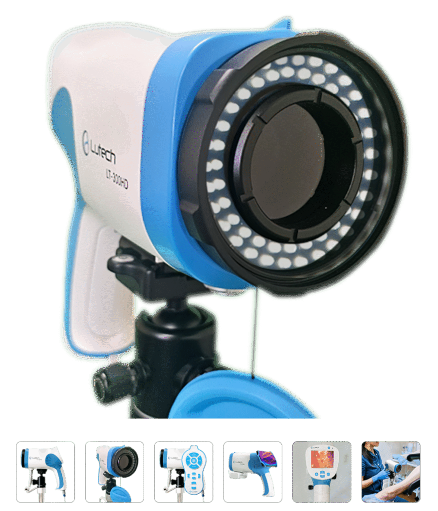 LT-300HD Colposcope - Lutech Medical