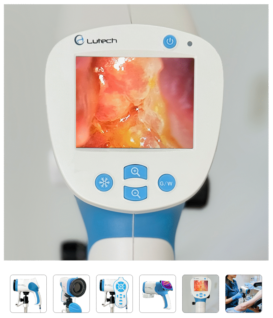 LT-300HD Colposcope - Lutech Medical