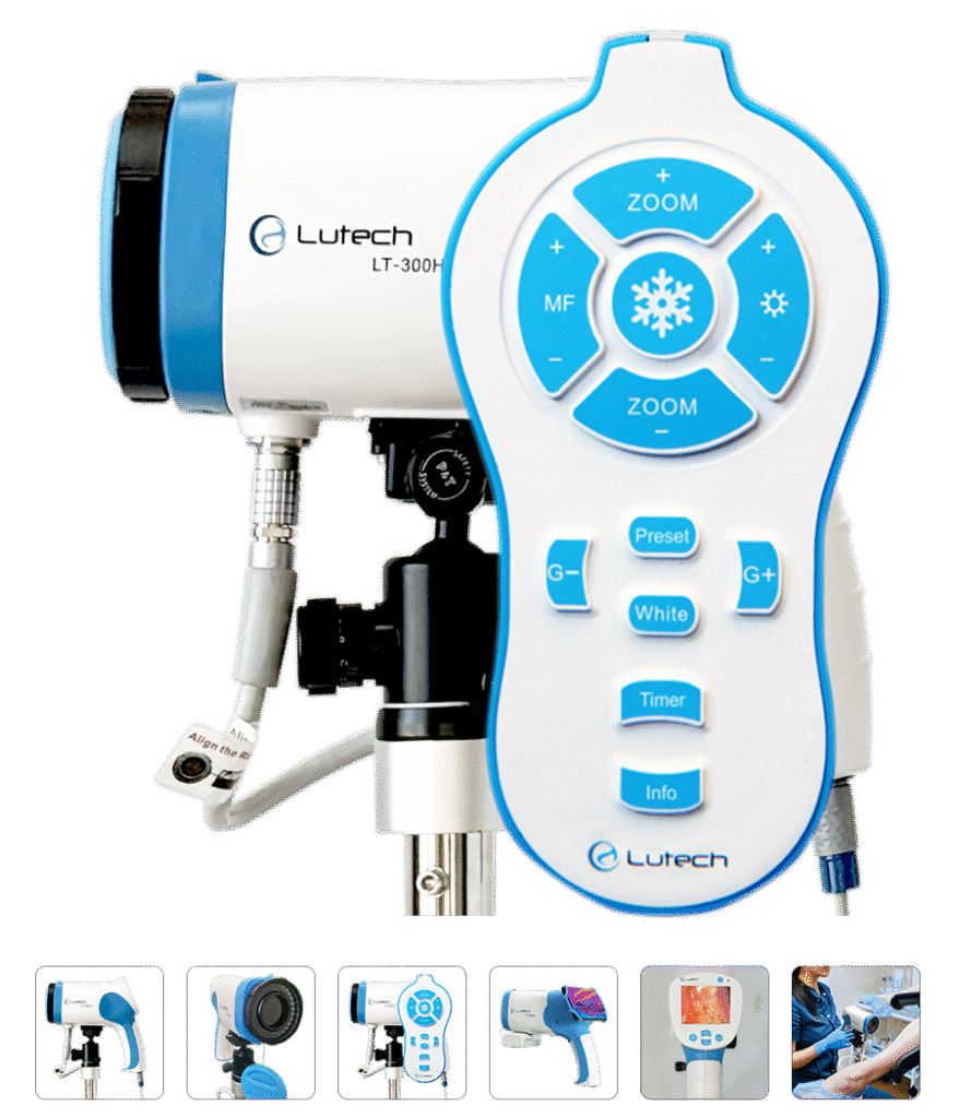 LT-300HD Colposcope - Lutech Medical
