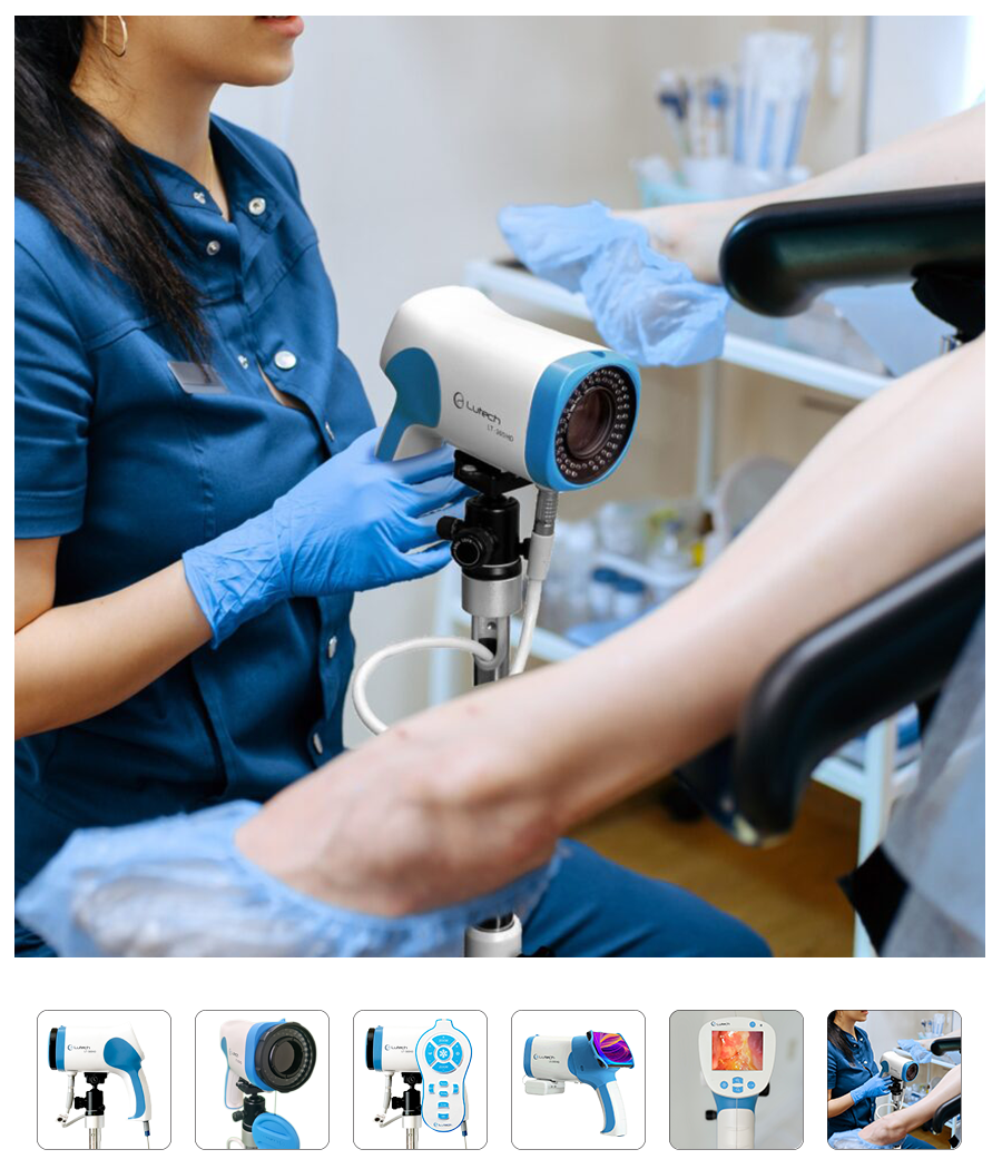 LT-300HD Colposcope - Lutech Medical
