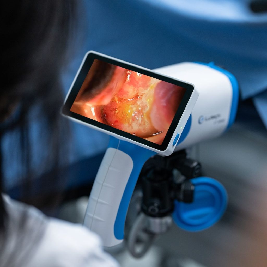 LT-300HD Digital Colposcope - Lutech Medical