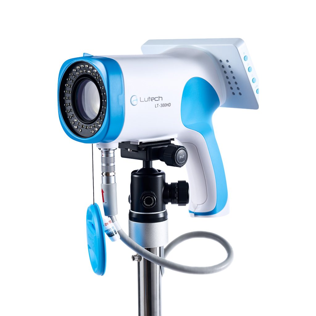 LT-300HD Digital Colposcope - Lutech Medical